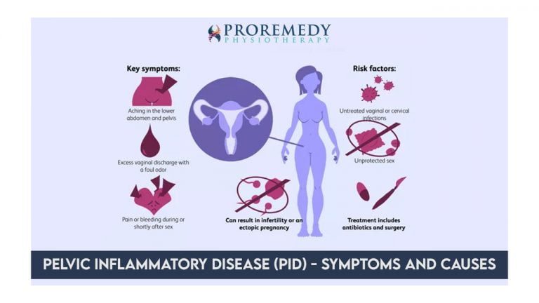 Pelvic inflammatory disease (PID) - Symptoms and causes